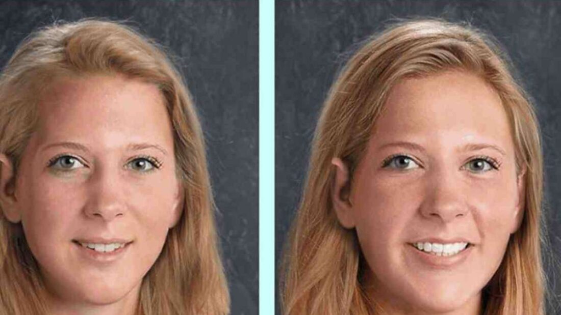 Come sarebbero oggi le gemelline Schepp: la ricostruzione