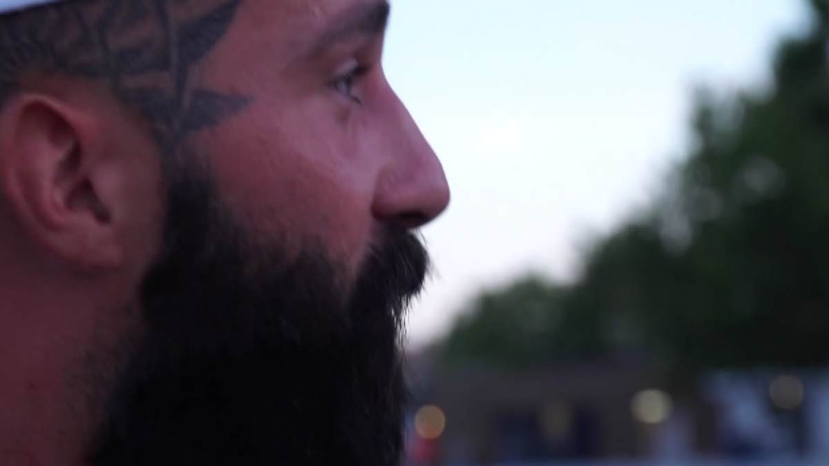 Chi è Ricky Free Rider: nome vero, età, incidente, lavoro e come sta oggi